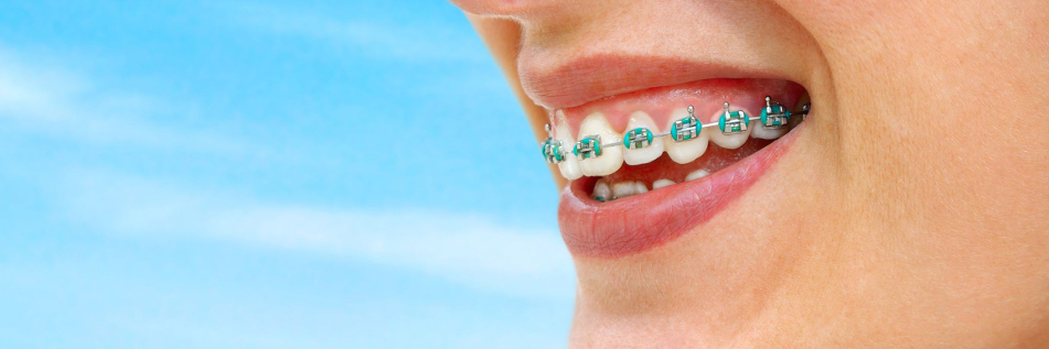 Dr Raymond Haddad | Orthodontiste à Fontenay-sous-Bois (94120) Tél. 01 ...